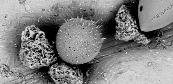 Under the Microscope: Tiny worm pellets | Department of Engineering